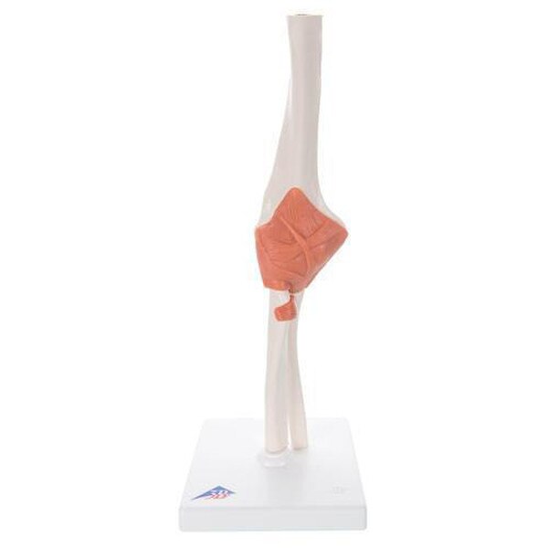 Functional Elbow Joint | DiaMedical USA