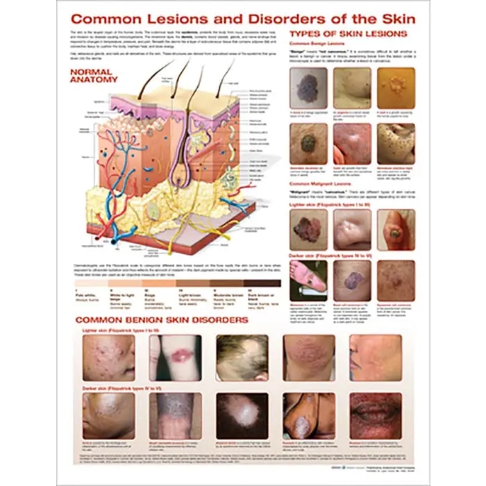 Lippincott® Common Lesions/Skin Disorders Chart | DiaMedical