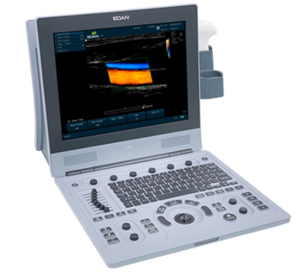 EDAN U60 Color Doppler Ultrasound | DiaMedical USA