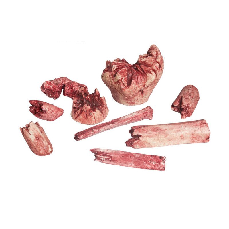 Moulage Sciences Simulated Bone Fragments | DiaMedical USA