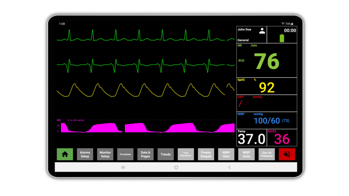SimVS EMS Virtual Diagnostic Platform with Simulaids STAT Manikin ...