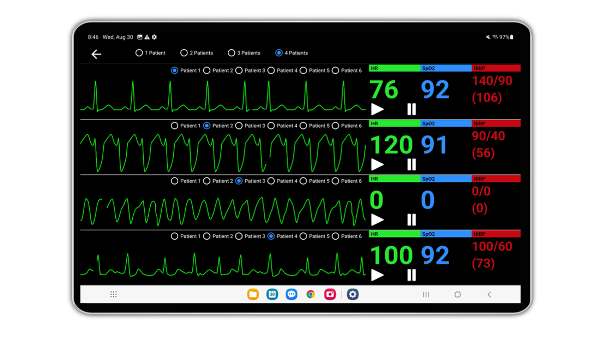 SimVS EMS Virtual Diagnostic Platform with Simulaids STAT Manikin ...