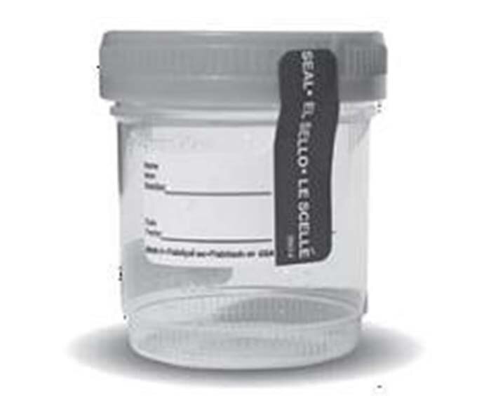 Alere Sterile Urine Specimen Collection Cups with Temperature Strips ...